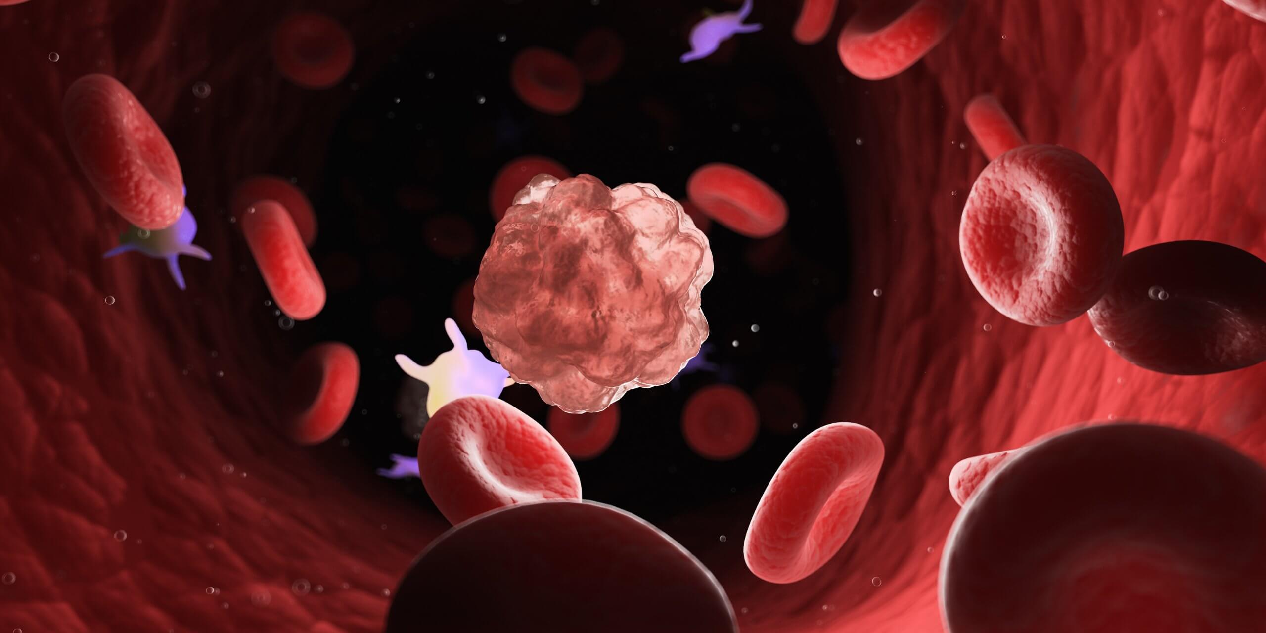 Gene Altering Therapy for Leukaemia Treatment | Cells4Life