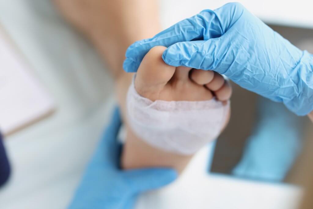 Can Stem Cell Therapy Heal Diabetic Foot Ulcers?